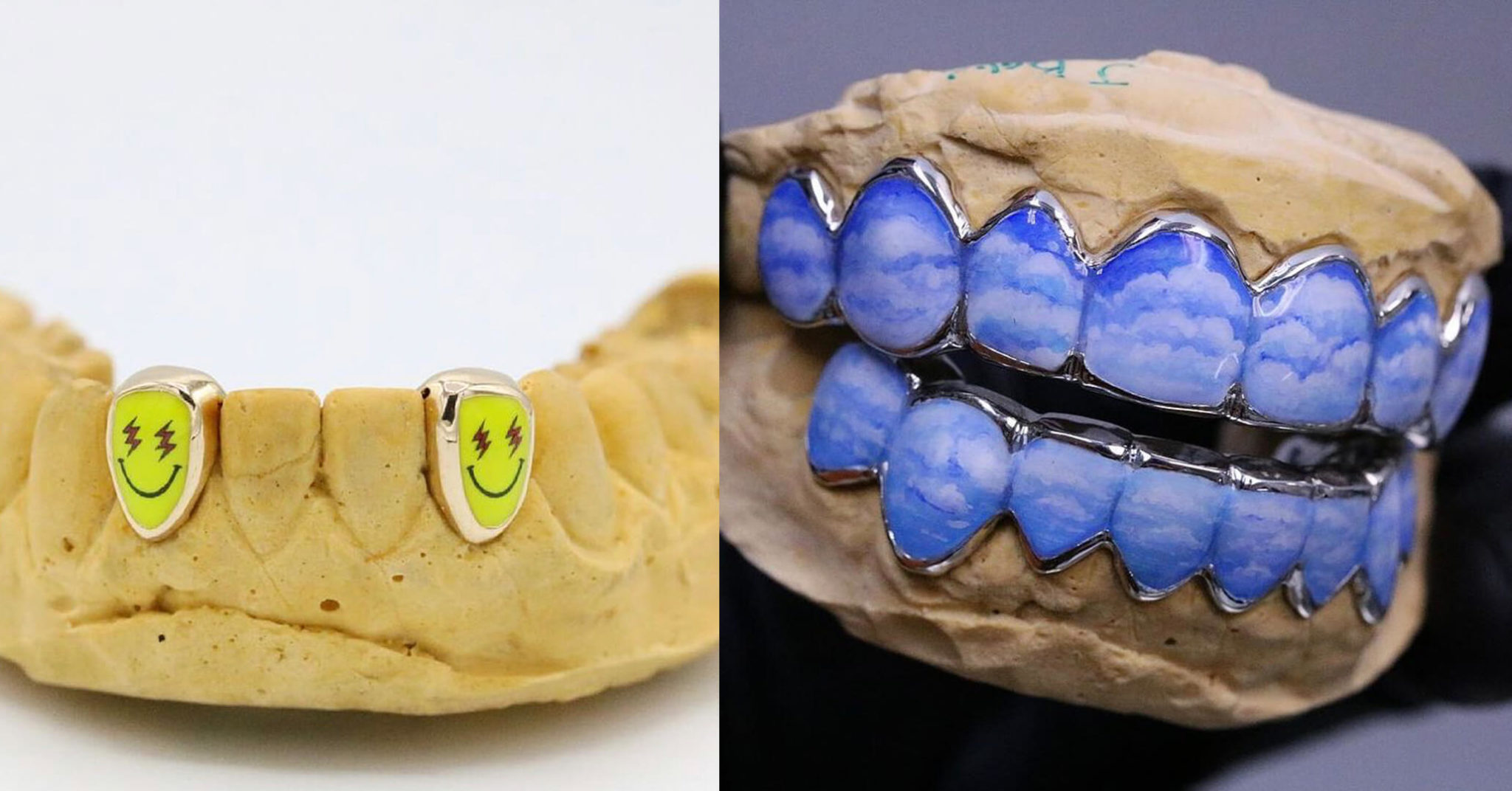 Grillz Like Fine Art: Lil Yachty & J Balvin Got ‘Em